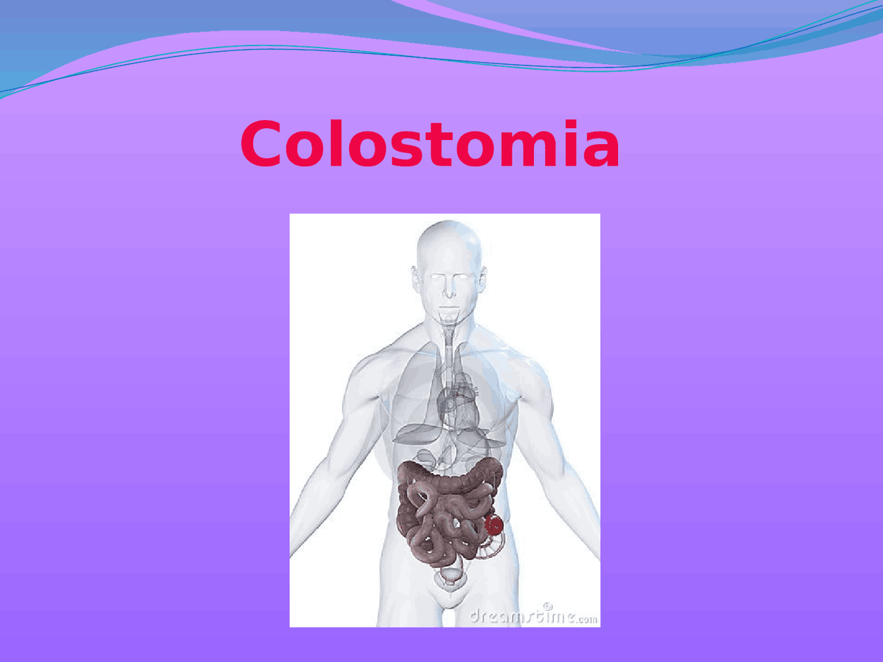 Colostomia Definição - o que é colostomia - Docsity