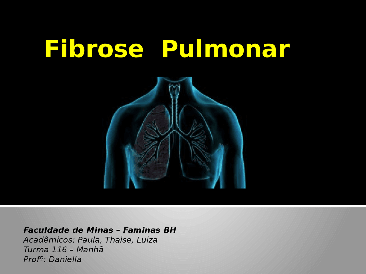 Fibrose Pulmonar - Slide Fibrose Pulmonar - Docsity