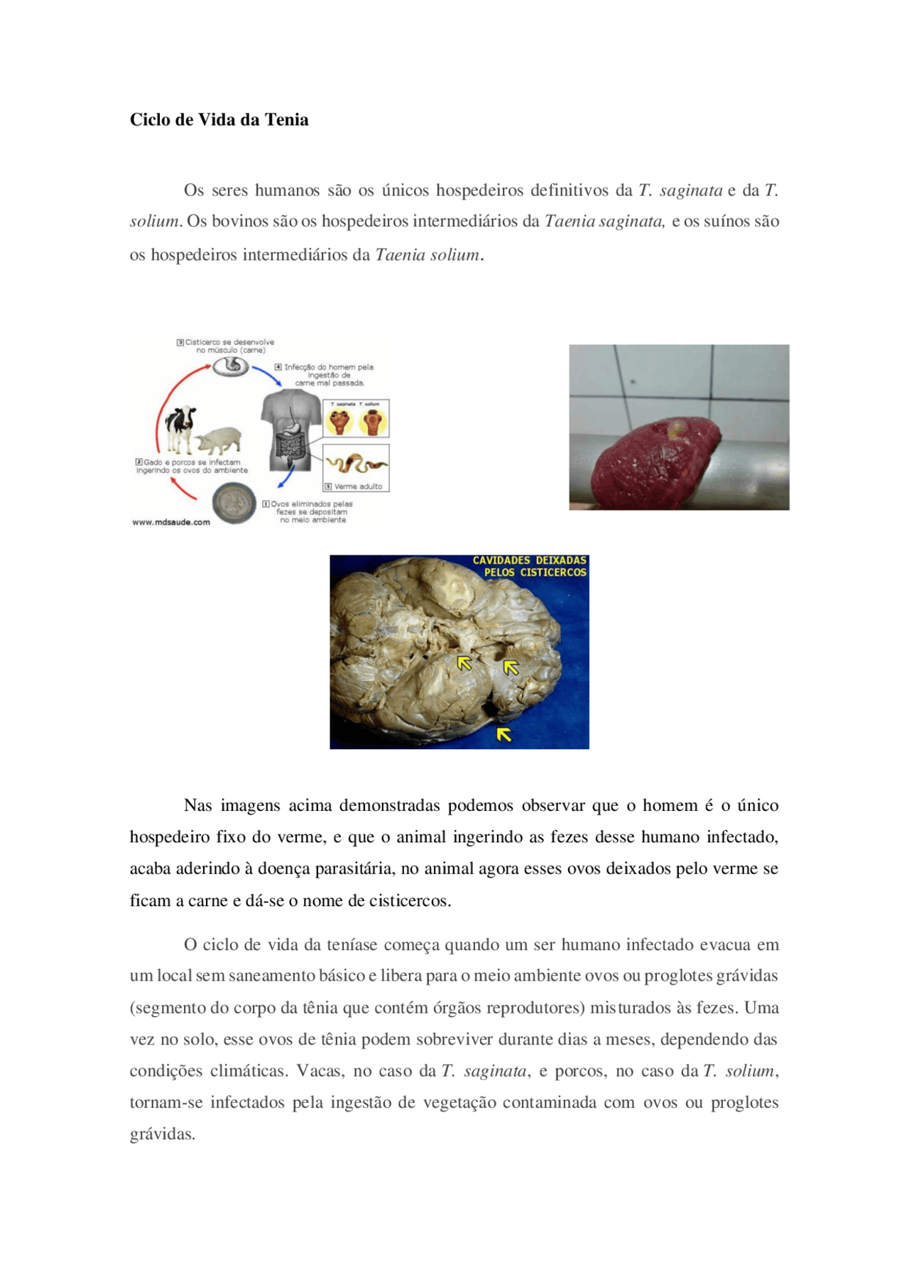 Teníase e Cisticercose Suína - Trabalho do aluno Emanuel Isaque ...