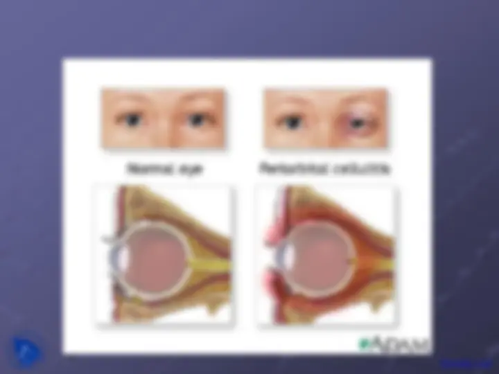 Diagnosis of Orbital Diseases - Introduction to Ophthalmology - Lecture ...