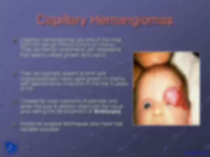 Diagnosis of Orbital Diseases - Introduction to Ophthalmology - Lecture Slides | Slides ...