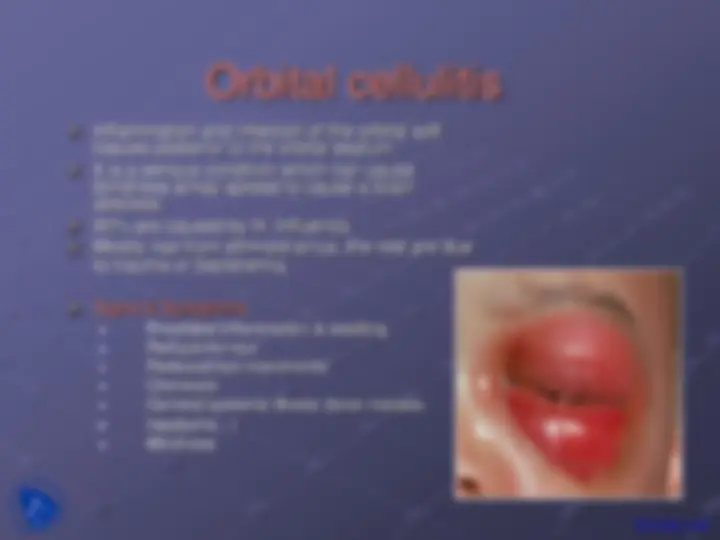 Diagnosis of Orbital Diseases - Introduction to Ophthalmology - Lecture Slides | Slides ...