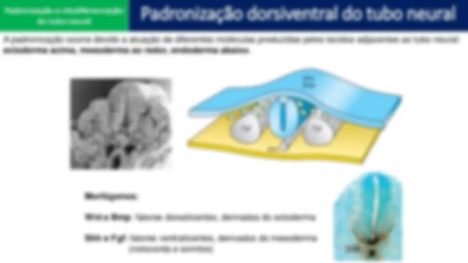 Desenvolvimento do Sistema Nervoso Central: Neurulação, Padronização e ...