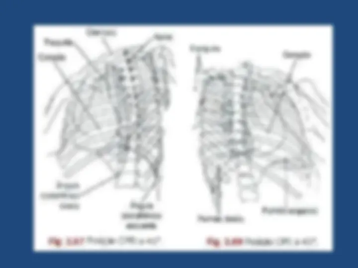 RADIOLOGIA MEDICA torax | Slides Radiologia | Docsity