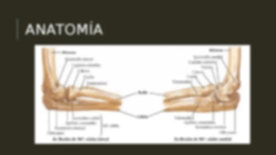 Fracturas de humero 4 | Diapositivas de Ortopedía | Docsity