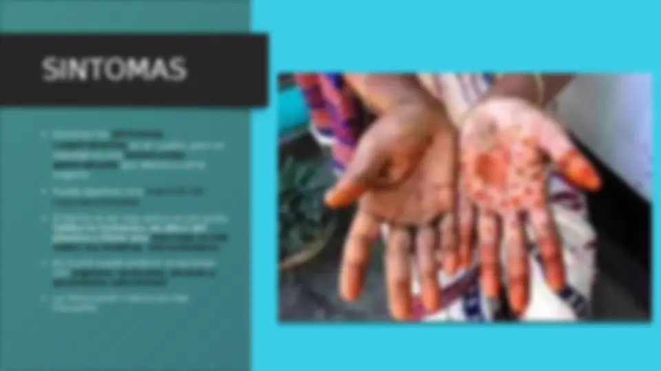 Beriliosis: Causas, Síntomas, Diagnóstico y Tratamiento | Diapositivas de Cardiología | Docsity