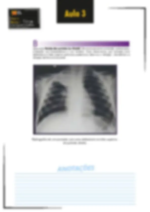 ABCDE do RX de Torax | Resumos Fisiopatologia | Docsity