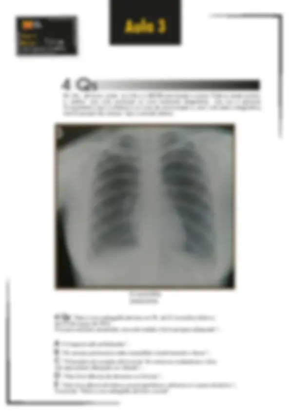 ABCDE do RX de Torax | Resumos Fisiopatologia | Docsity