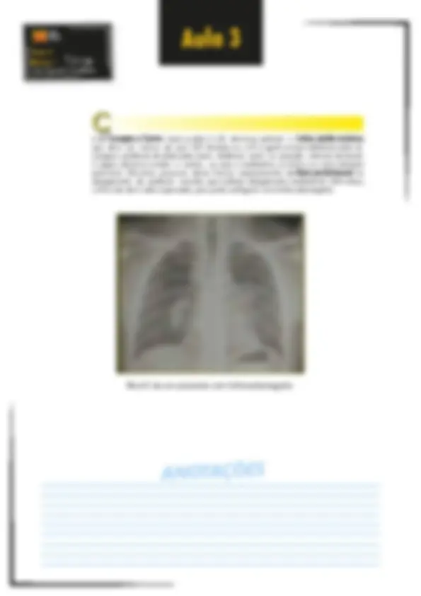 ABCDE do RX de Torax | Resumos Fisiopatologia | Docsity