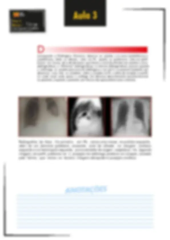 ABCDE do RX de Torax | Resumos Fisiopatologia | Docsity