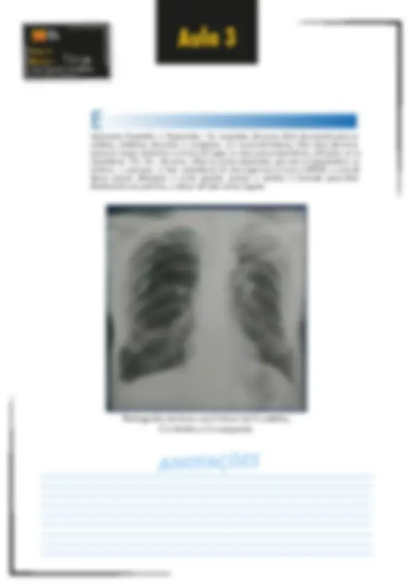 ABCDE do RX de Torax | Resumos Fisiopatologia | Docsity