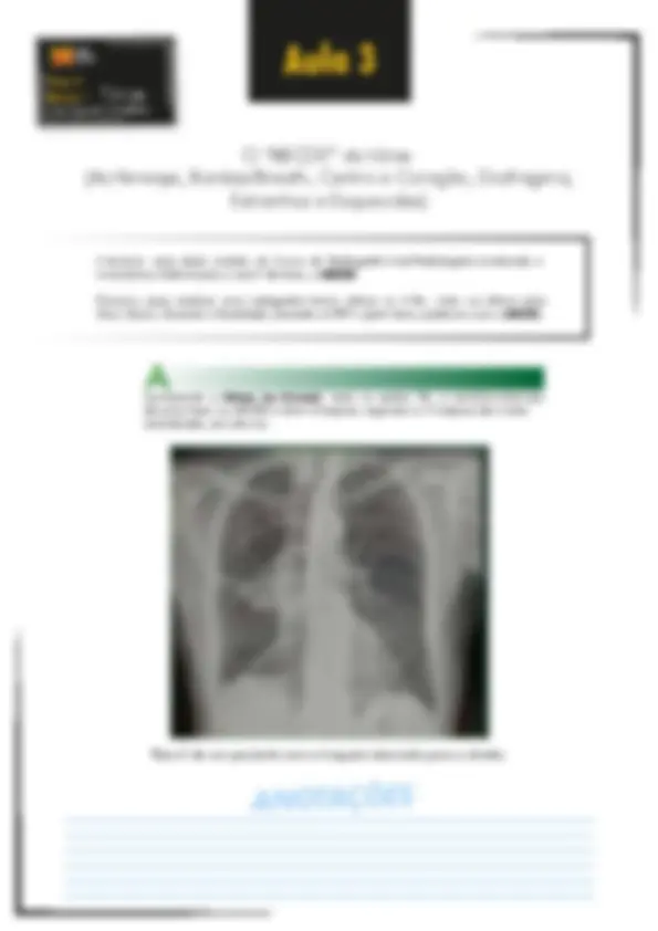 ABCDE do RX de Torax | Resumos Fisiopatologia | Docsity