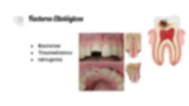 Diagnostico de caries, lesiones pulpares y periodontales ...