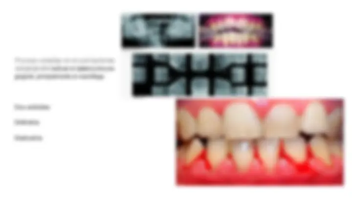 Diagnostico de caries, lesiones pulpares y periodontales ...