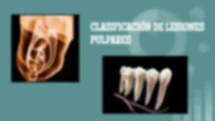 Diagnostico de caries, lesiones pulpares y periodontales ...