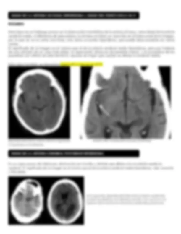 signos radiologicos | Resúmenes de Radiología | Docsity
