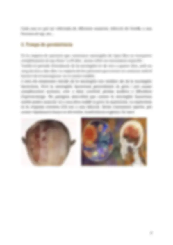 Meningitis: Tipos, Causas, Síntomas y Tratamiento | Resúmenes de ...