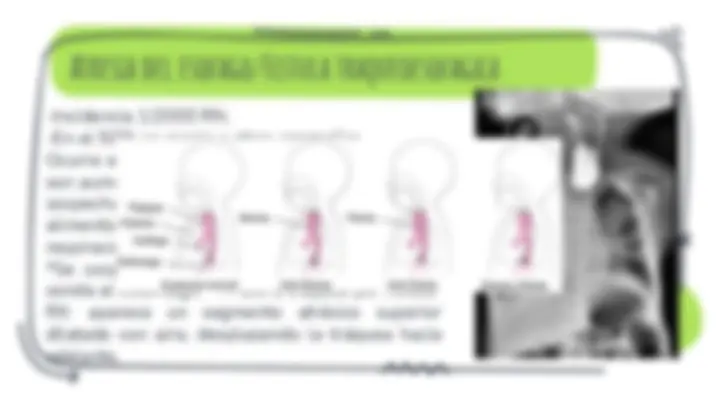 Aparato digestivo/Esofago | Diapositivas de Imagenología | Docsity