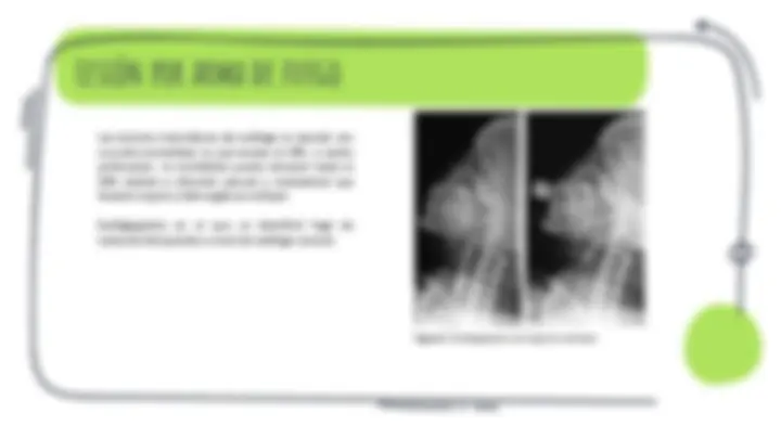 Aparato digestivo/Esofago | Diapositivas de Imagenología | Docsity