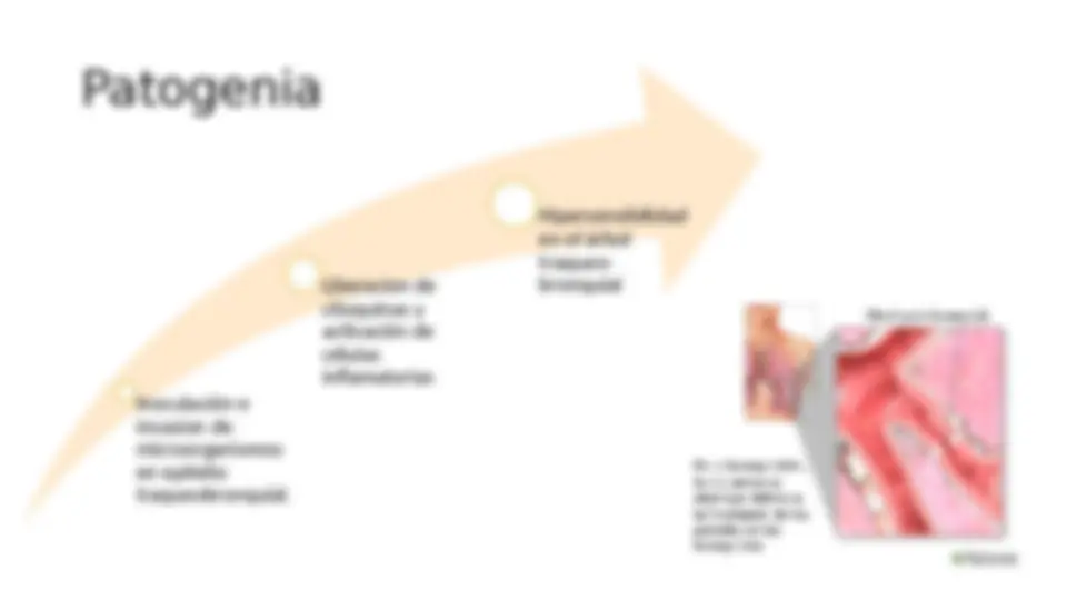 Bronquitis Aguda: Significado, Causas, Sintomas, Diagnóstico y Tratamiento | Diapositivas de ...