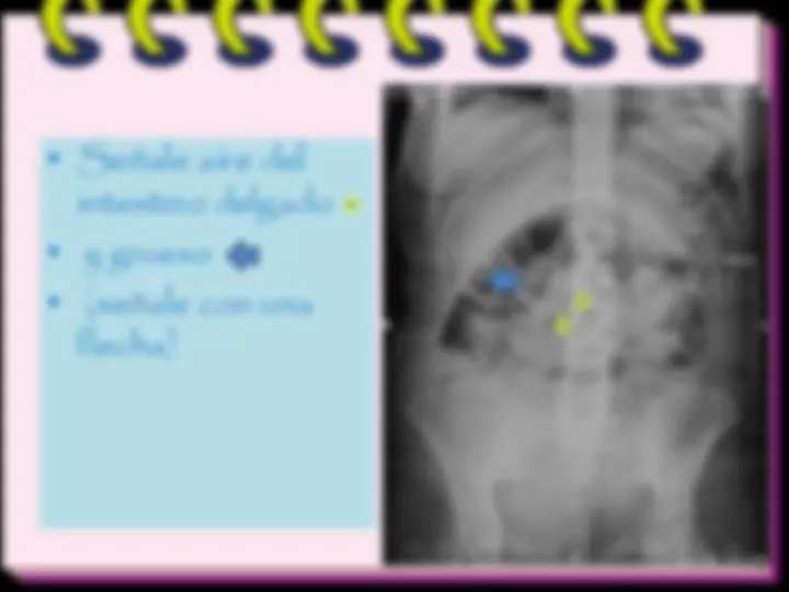 Radiografía de Abdomen: Identificación de Estructuras y Anomalías ...
