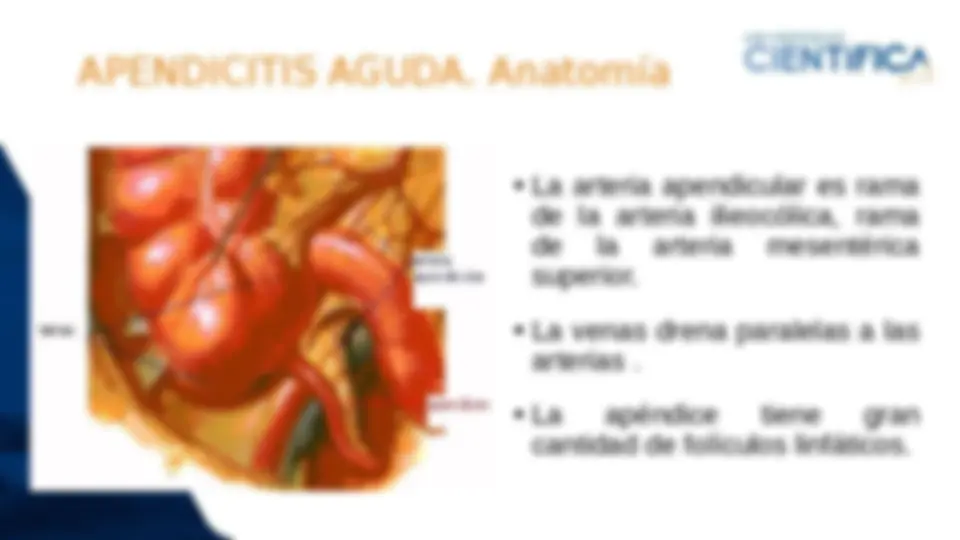 Apendicitis Aguda: Historia, Generalidades, Diagnóstico y Tratamiento ...