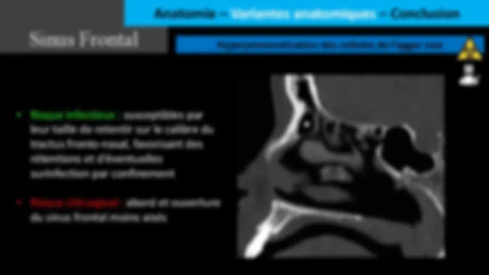 Variantes anatomiques des sinus de la face | Schémas Anatomie | Docsity