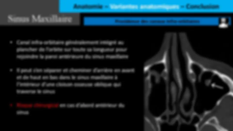 Variantes anatomiques des sinus de la face | Schémas Anatomie | Docsity