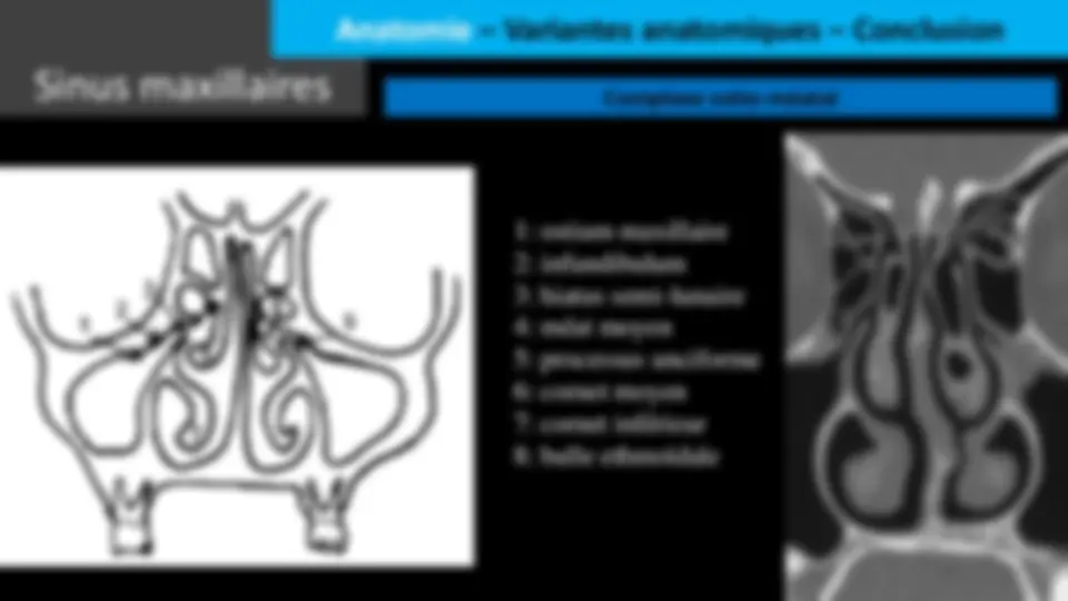 Variantes anatomiques des sinus de la face | Schémas Anatomie | Docsity