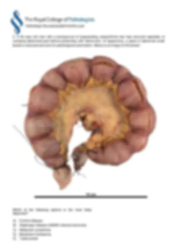 FRCPath Part 1 in Histopathology Sample MCQ and EMQs | Lecture notes ...