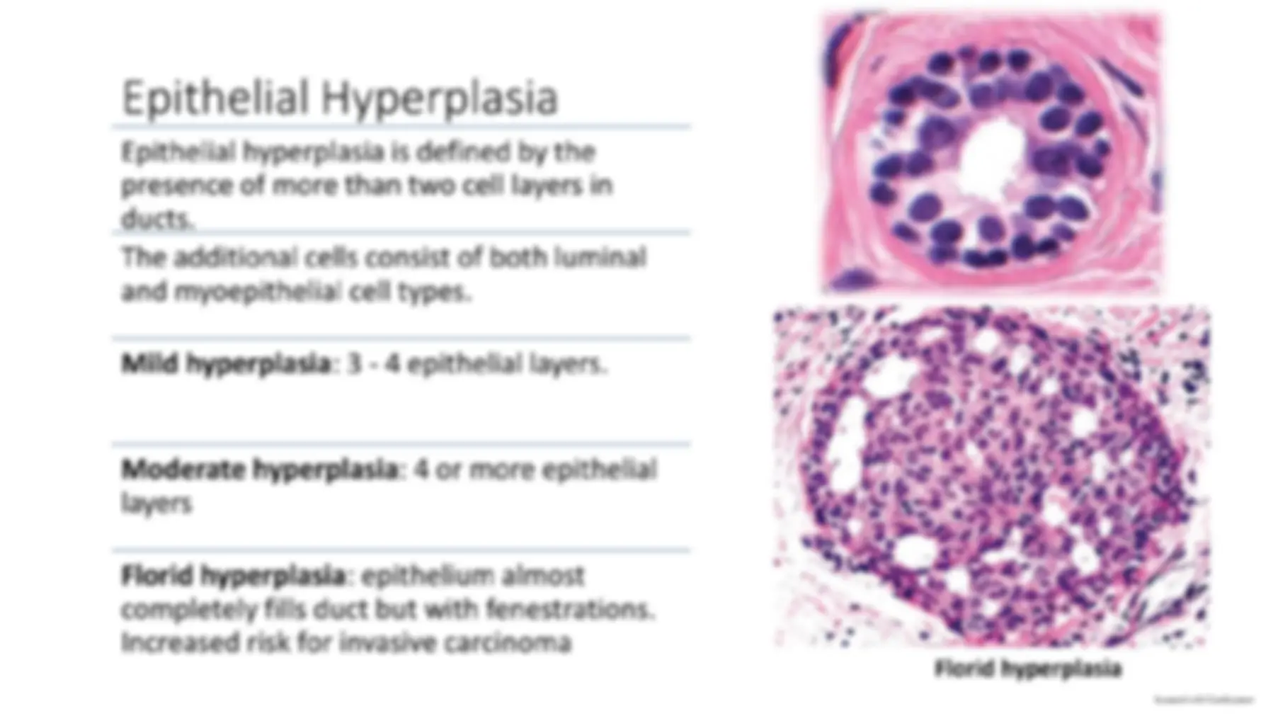Benign breats epithelial lesions patho | Slides Pathology | Docsity