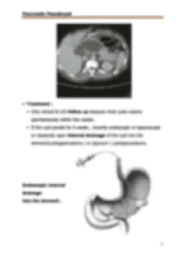 Pancreatic Pseudocyst | Study Guides, Projects, Research Medical ...