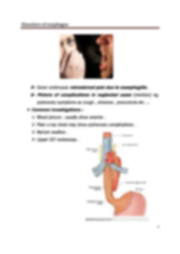Disorders of esophagus | Study Guides, Projects, Research Medical ...
