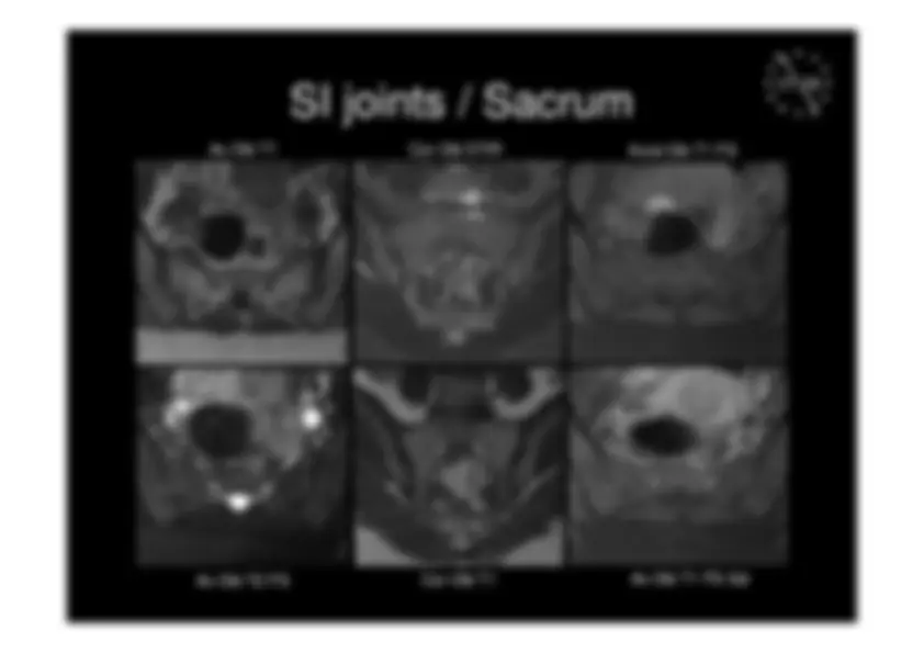 SI joints sacrum | Study notes Radiology | Docsity