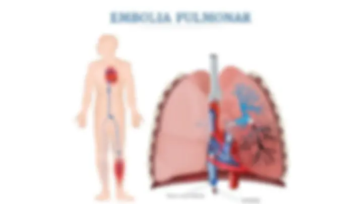 diapositivas que explican lo que es la embolia venosa y sus similares ...