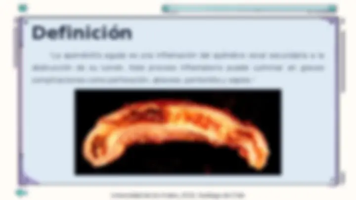 Apendicitis, fisiologia, anatomía y resolución quirúrgica | Esquemas y ...