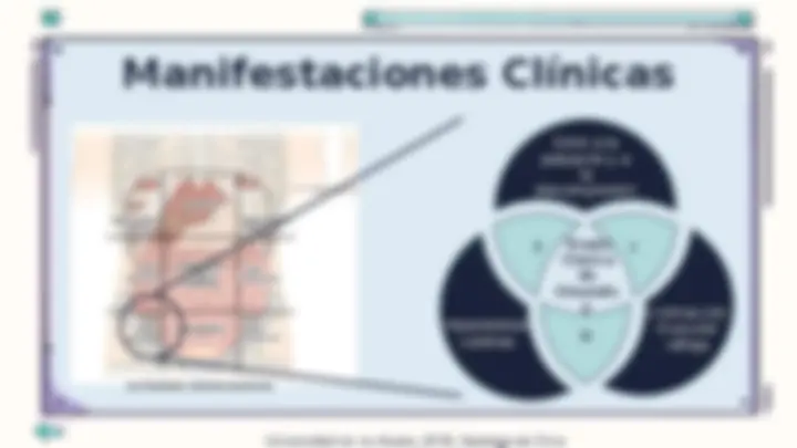 Apendicitis, fisiologia, anatomía y resolución quirúrgica | Esquemas y ...
