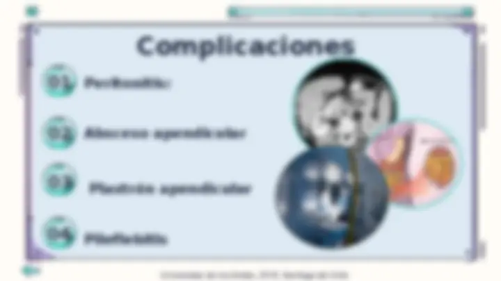 Apendicitis, fisiologia, anatomía y resolución quirúrgica | Esquemas y ...