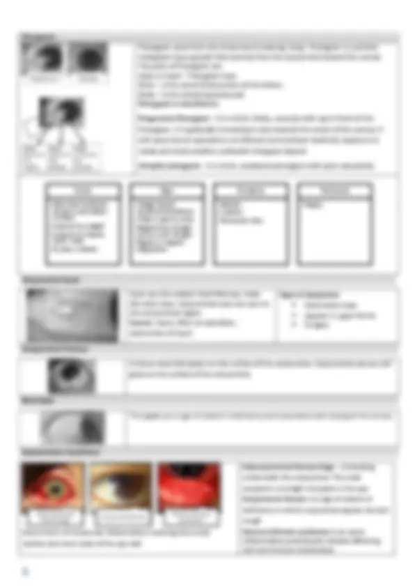 Diseases and Disorders of Conjunctiva | Lecture notes Pathology | Docsity