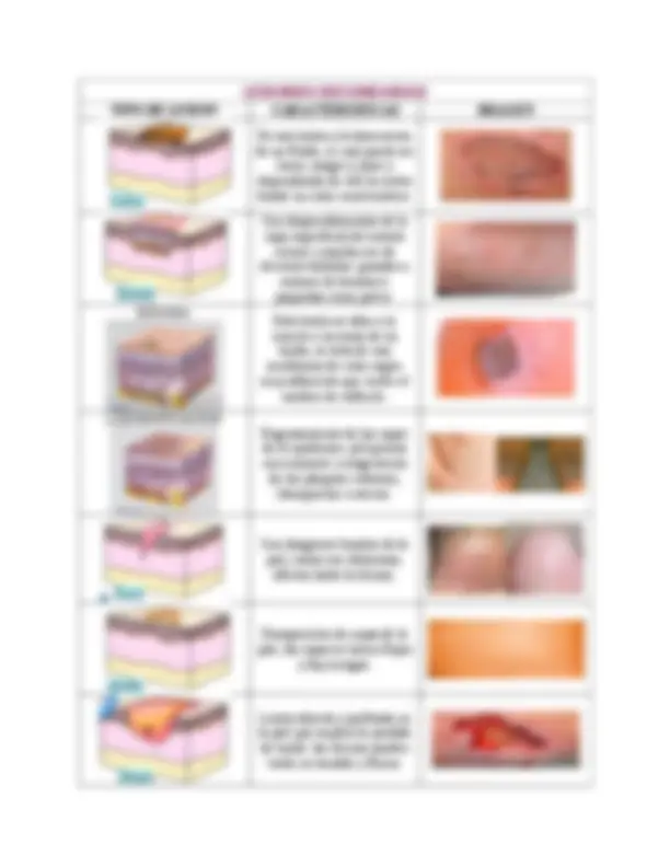 Lesiones Primarias y Secundarias: Tipos, Características y Imágenes | Esquemas y mapas ...