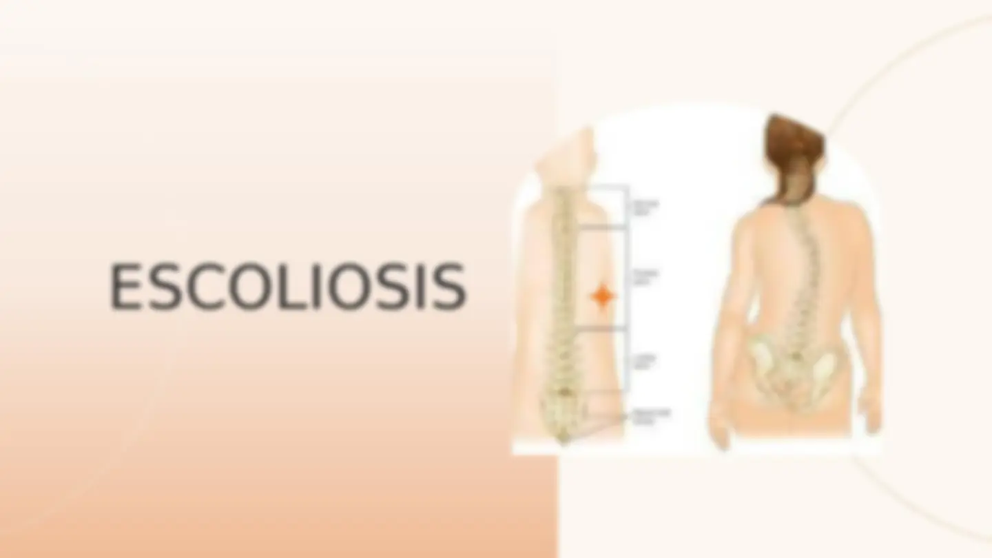 Esguince de tobillo: Evaluación y tratamiento fisioterapéutico ...