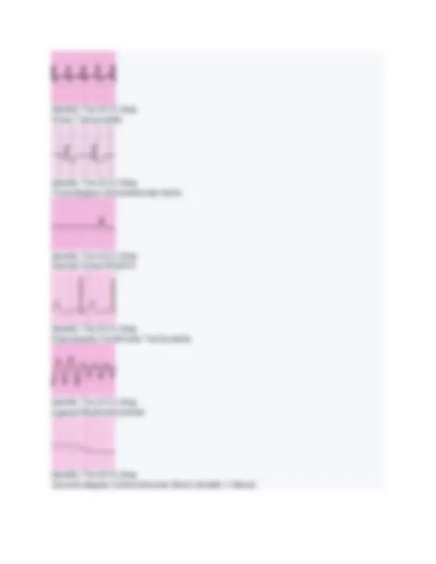 ACLS Pre-Course Self-Assessment: Identifying and Managing Cardiac Arrest Rhythms | Exams Nursing ...