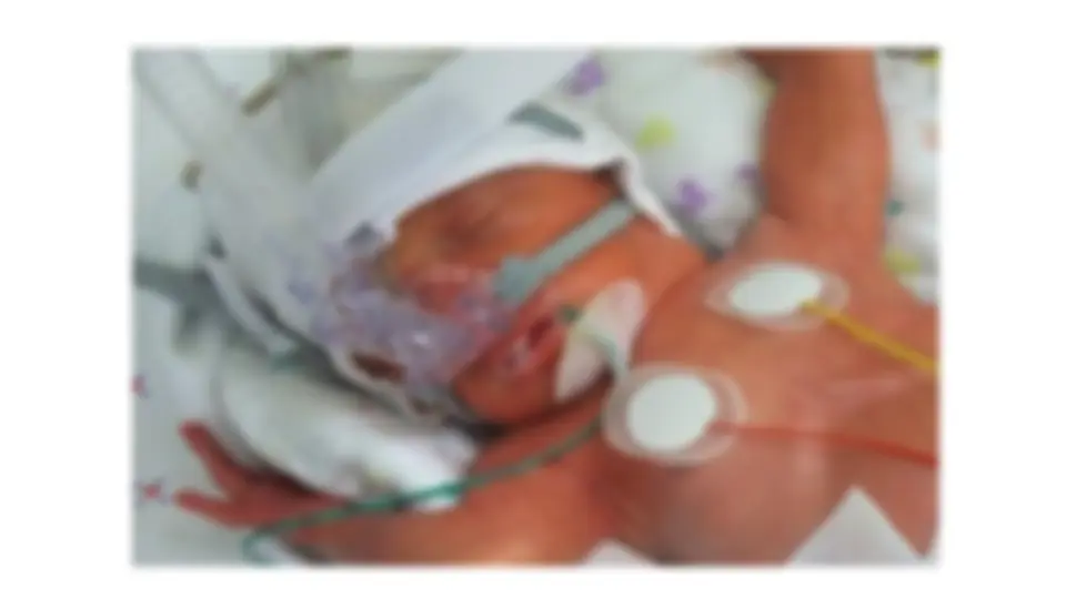 Mecanismos de defensa del sistema respiratorio | Esquemas y mapas ...