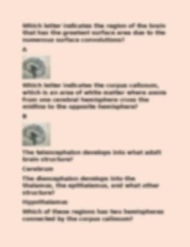Nightingale Anatomy Final Chapter 13 & 14(with answers and diagrams ...