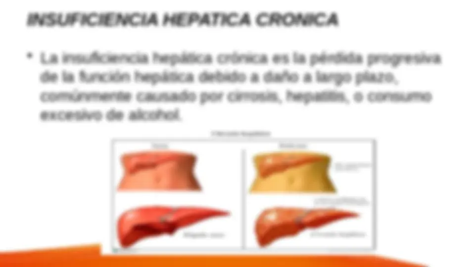 Insuficiencia Hepática: Causas, Síntomas, Diagnóstico y Tratamiento ...