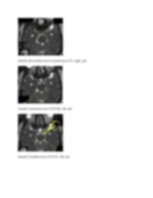 ARRT MRI Exam Study Guide: Questions and Answers (Latest Update ...