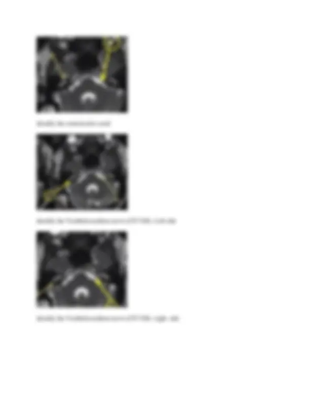 ARRT MRI Exam Study Guide: Questions and Answers (Latest Update ...