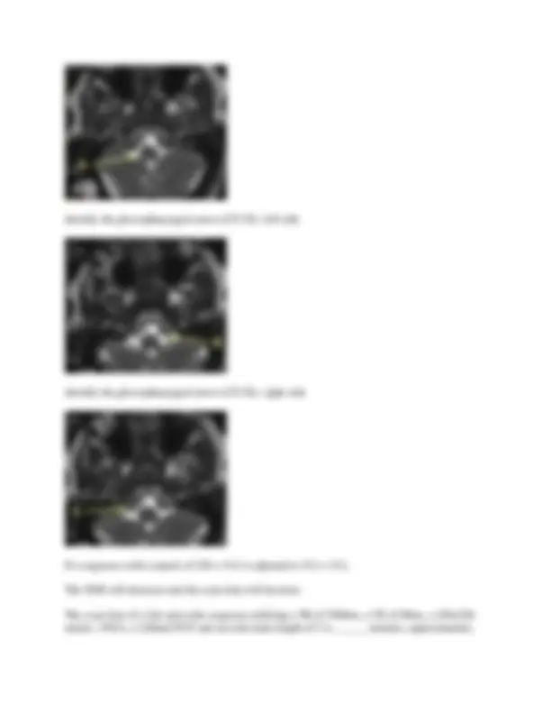 ARRT MRI Exam Study Guide: Questions and Answers (Latest Update ...