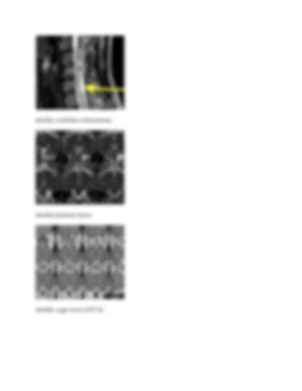 ARRT MRI Exam Study Guide: Questions and Answers (Latest Update ...