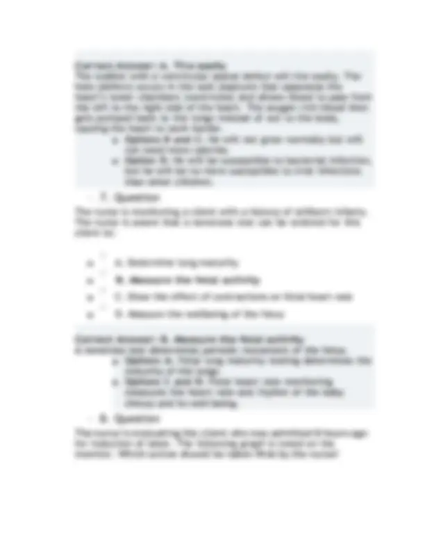 Nclex-Rn Actual Exam Question Paper 2025 Update (VERSION 2). Summer ...